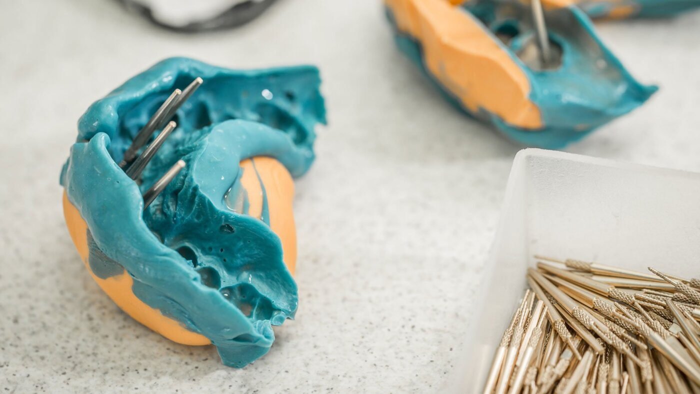 Best Dental Clinic in Hyderbad | Ardent Dental Care and Implant Centre